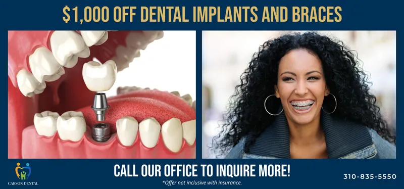 Carson Dental | Dental Care | Dentist in Carson, CA